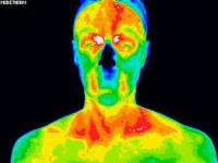 Thermography Breast Thermal | Thermography
